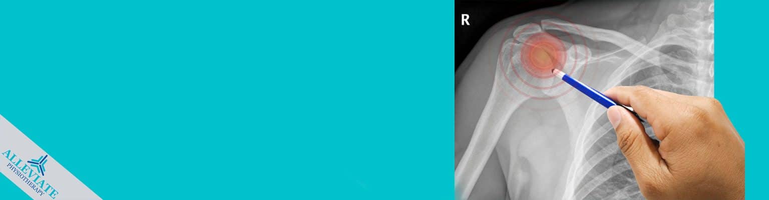 Rotator Cuff Dysfunction - Alleviate Physiotherapy